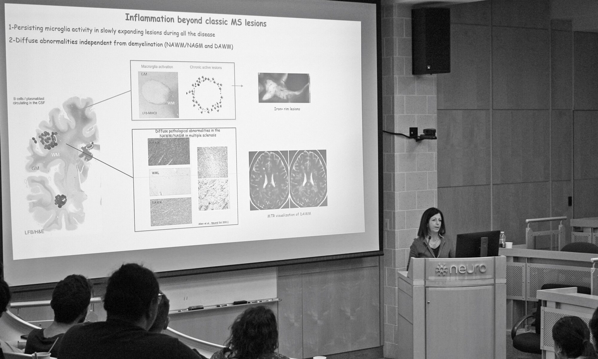 The Neuro’s Killam Seminar Series explores inflammation in multiple sclerosis - The Tribune